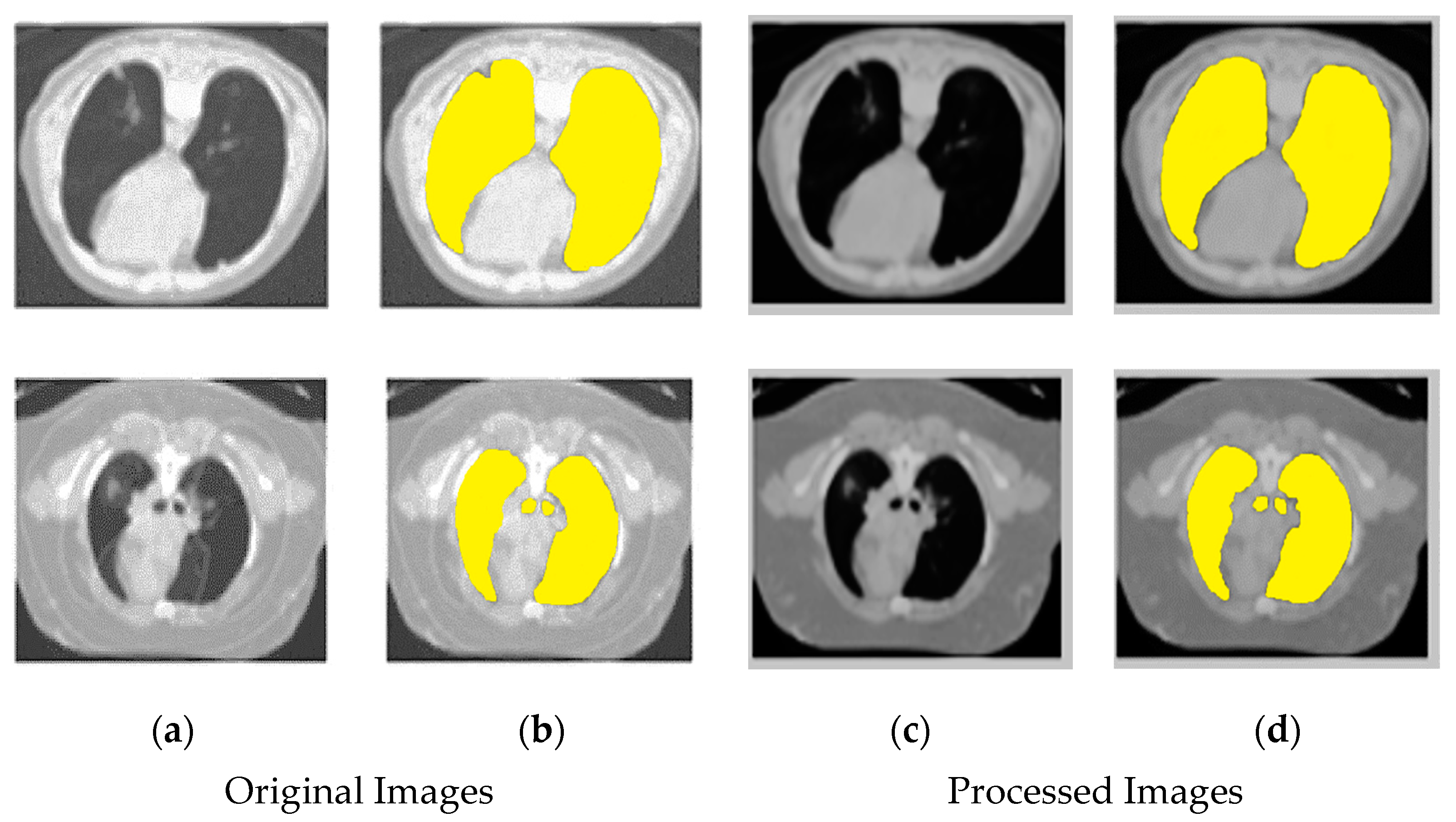 Applied Sciences | Free Full-Text | Lung’s Segmentation Using Context ...
