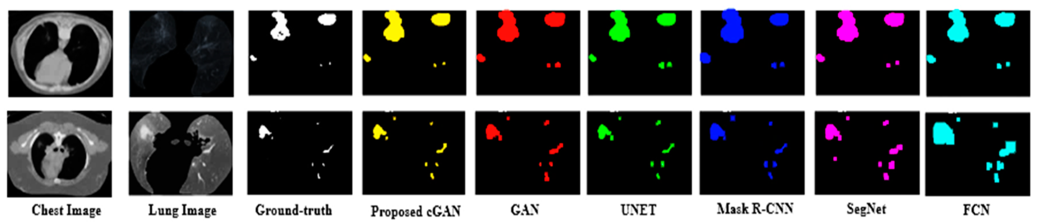 Applied Sciences | Free Full-Text | Lung’s Segmentation Using Context ...