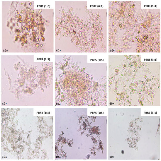 Optimization of Microalgae–Bacteria Consortium in the Treatment of ...