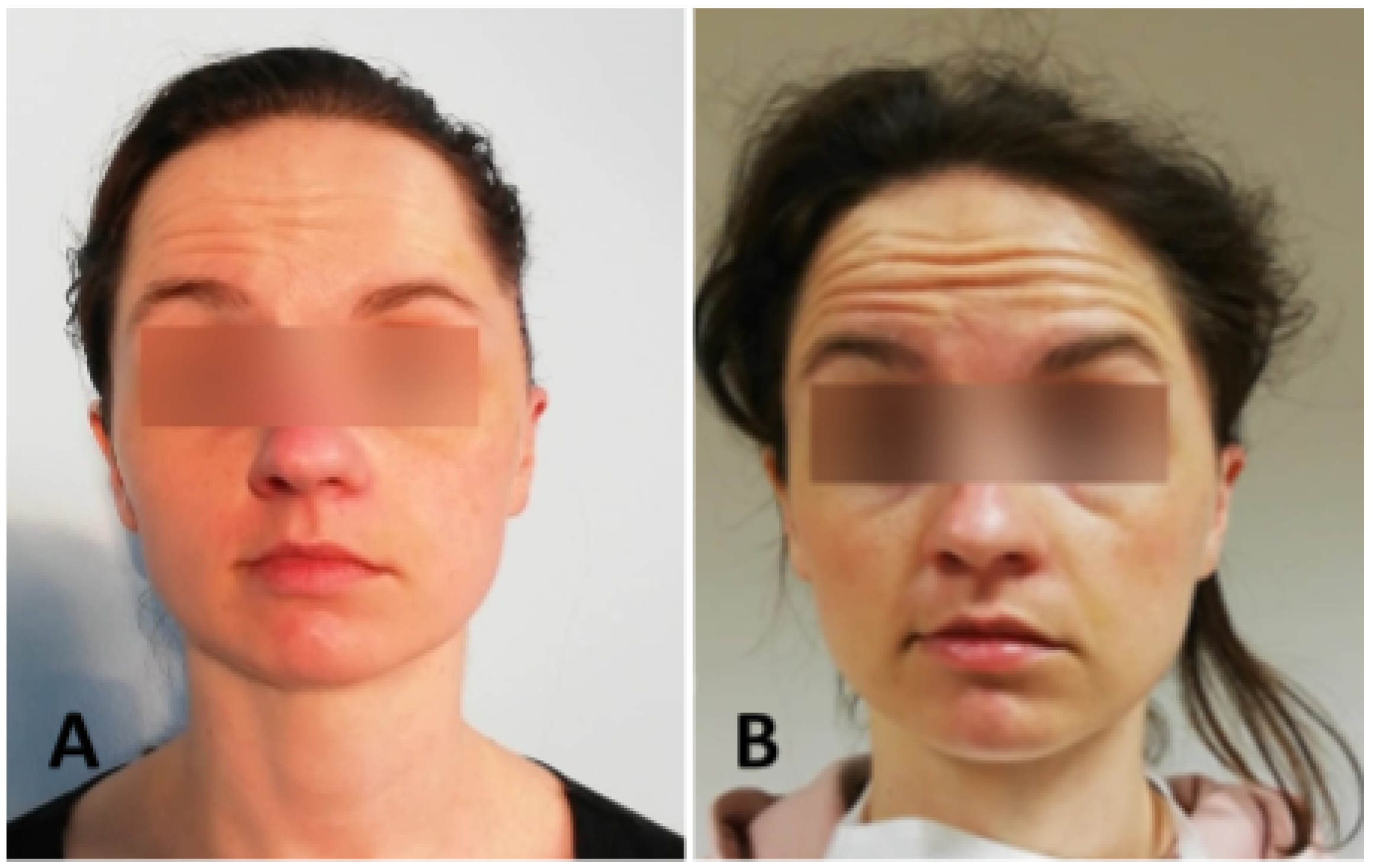 Advanced Analysis of 3D Kinect Data: Supervised Classification of ...