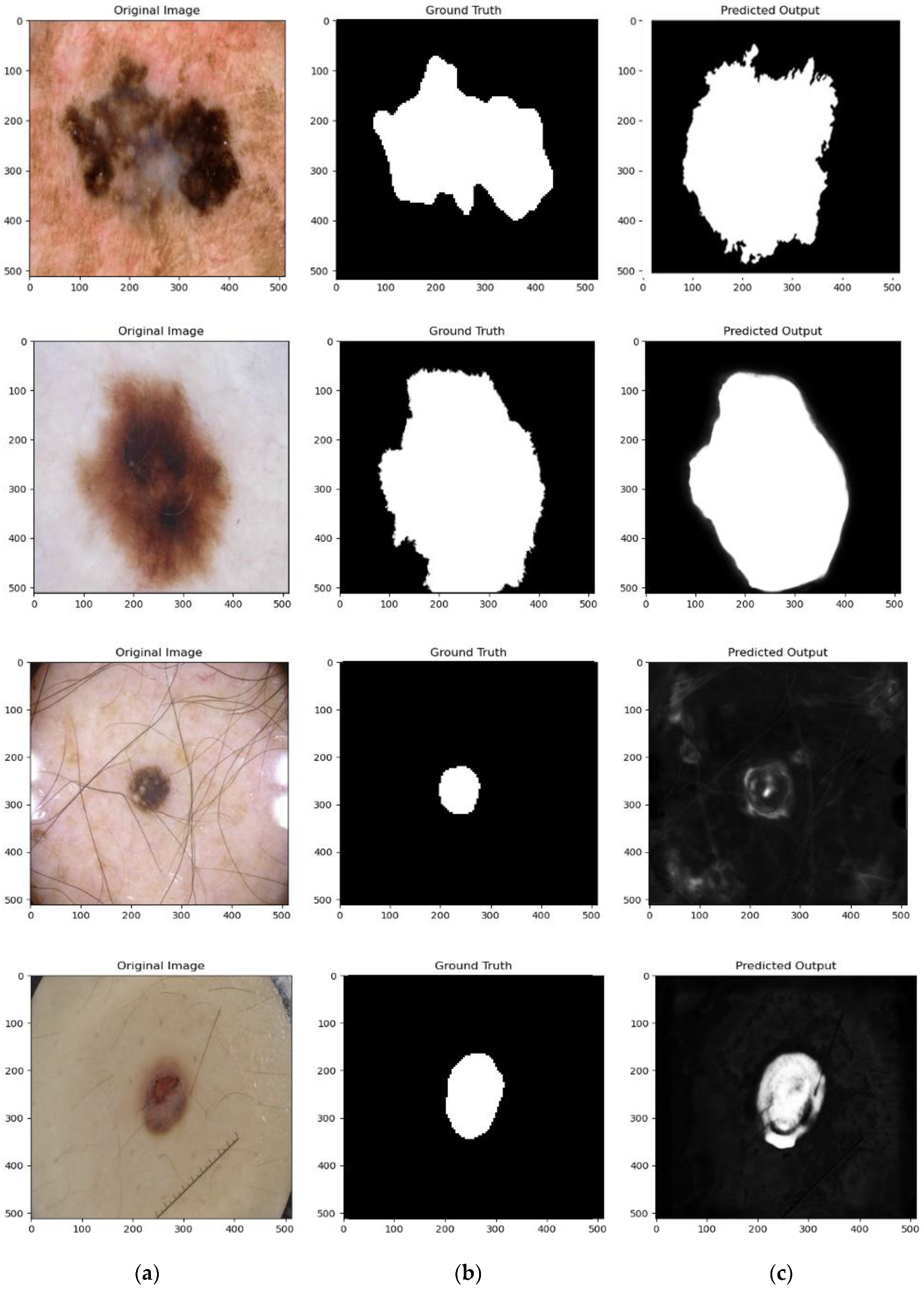 Applied Sciences | Free Full-Text | Skin Lesion Segmentation Based on ...