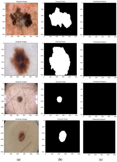 Skin Lesion Segmentation Based on Vision Transformers and Convolutional ...