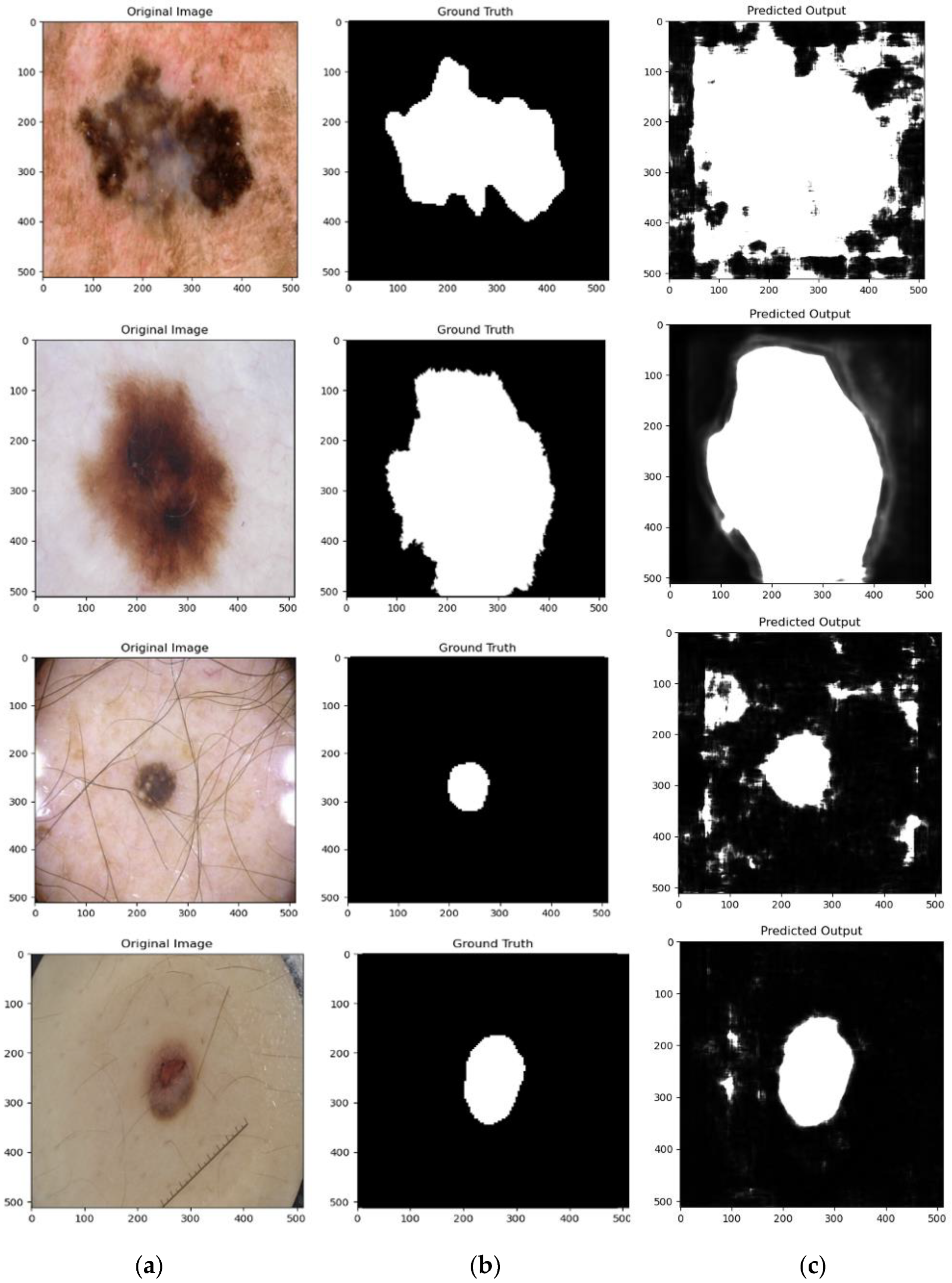 Skin Lesion Segmentation Based on Vision Transformers and Convolutional ...