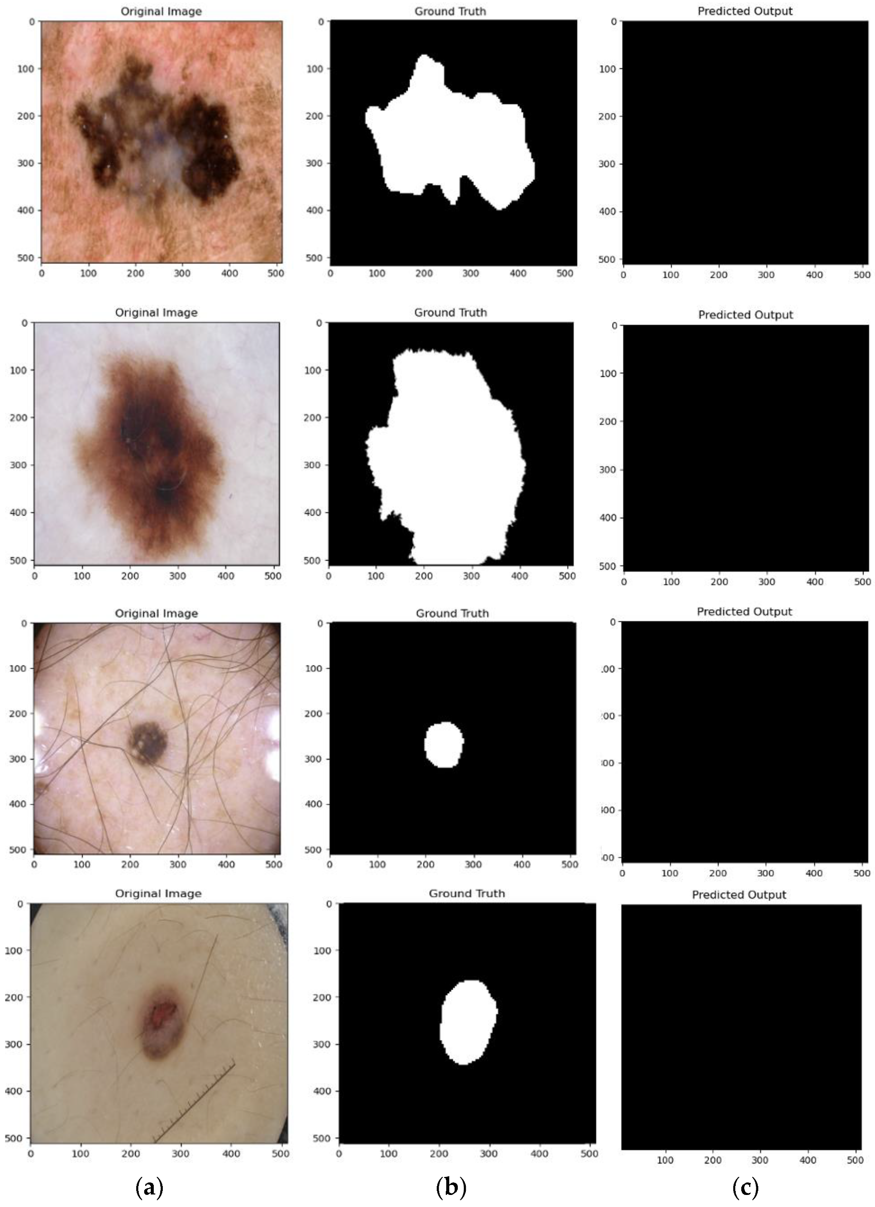 Skin Lesion Segmentation Based on Vision Transformers and Convolutional ...