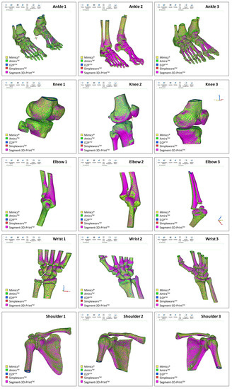 Comparison of Bone Segmentation Software over Different Anatomical Parts