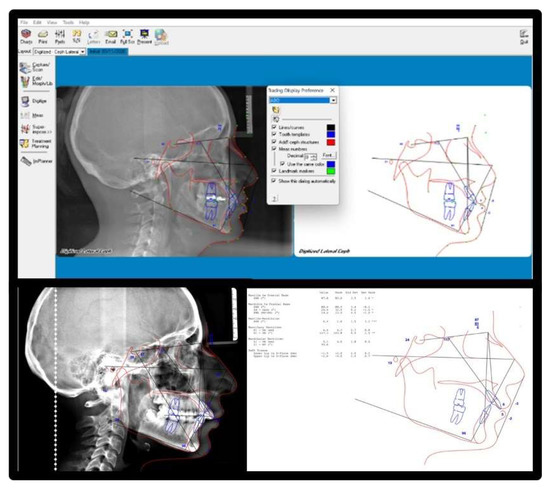Medical Image Analysis