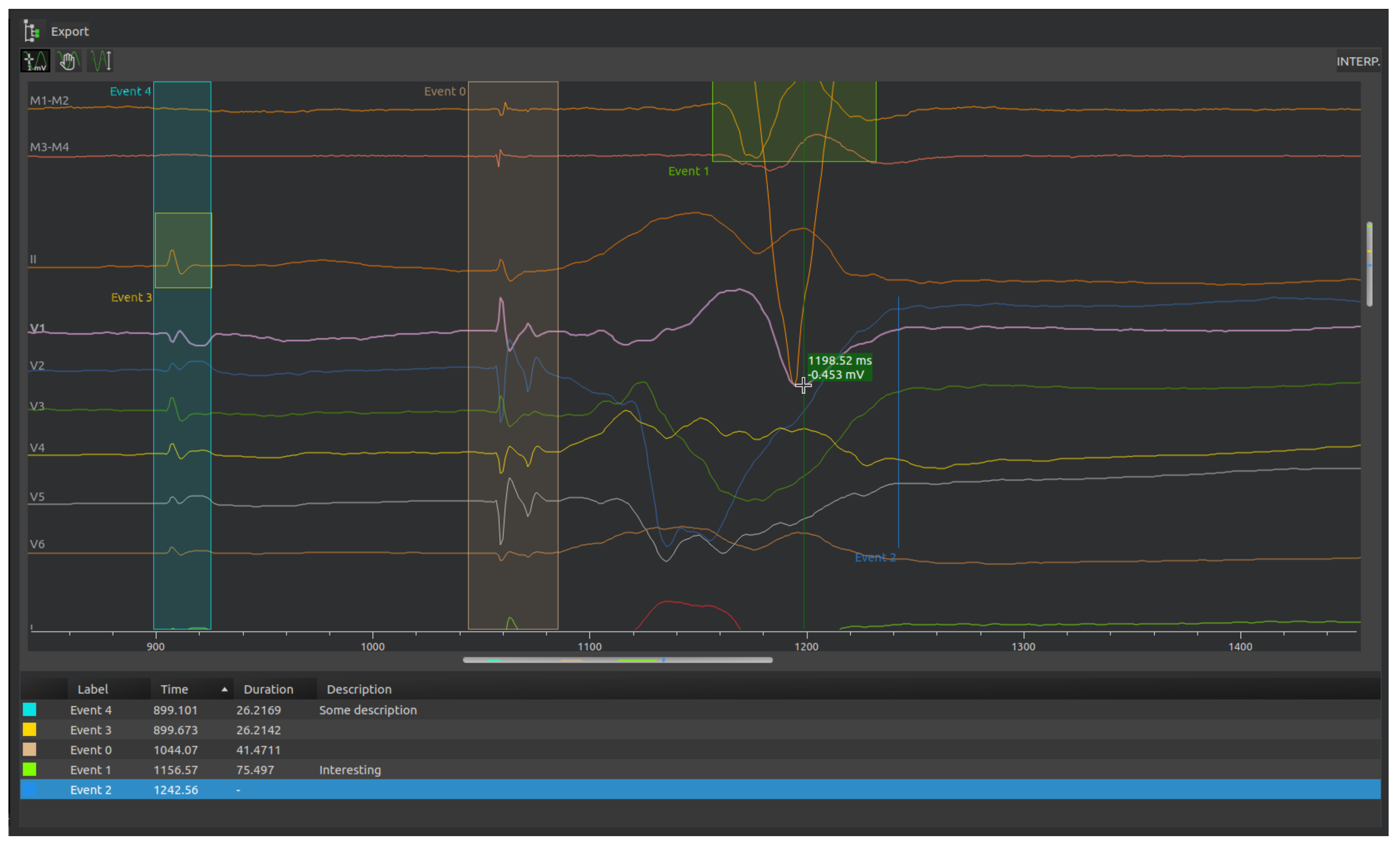 MUSIC: Cardiac Imaging, Modelling and Visualisation Software for ...