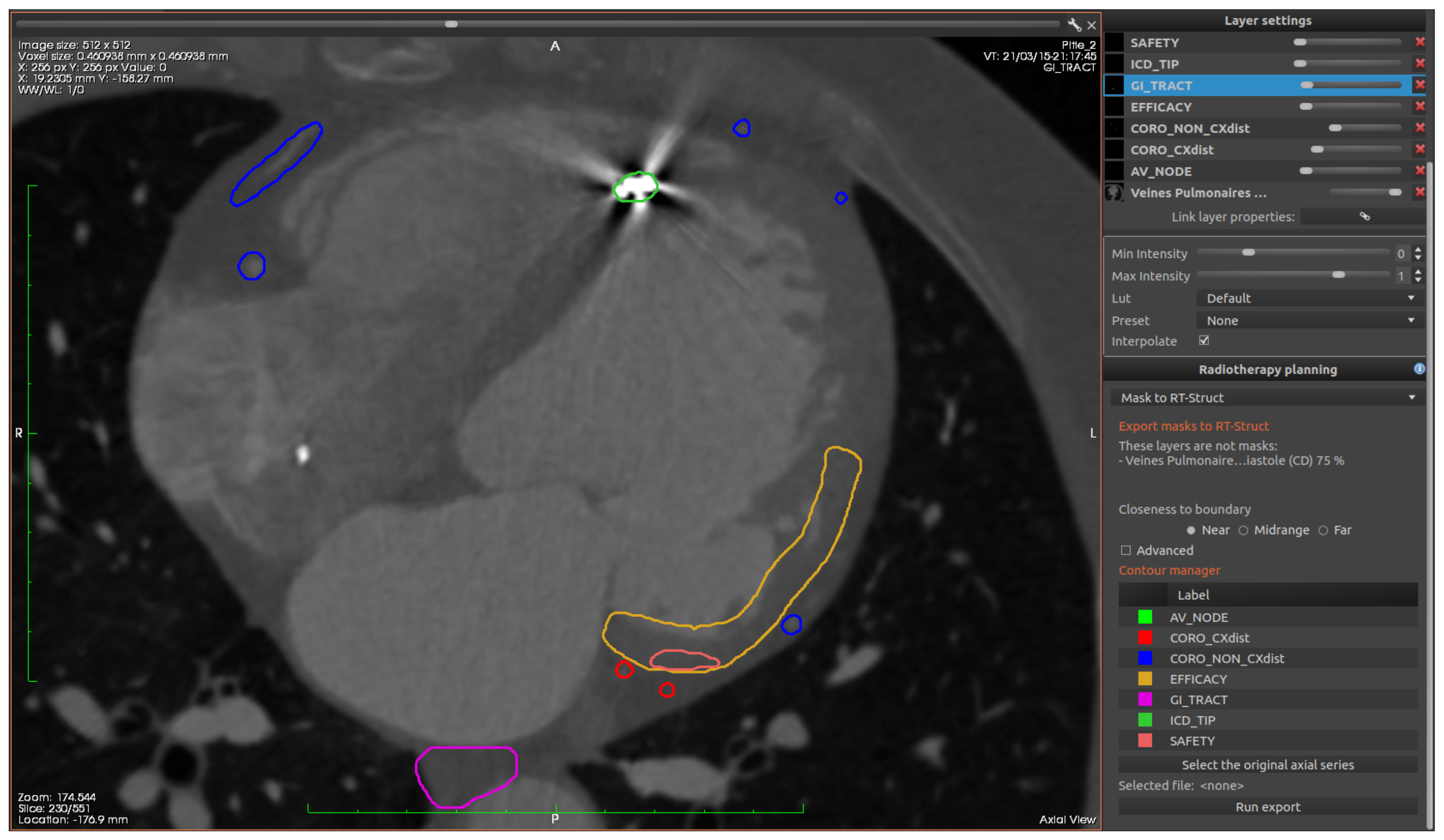 MUSIC: Cardiac Imaging, Modelling and Visualisation Software for ...