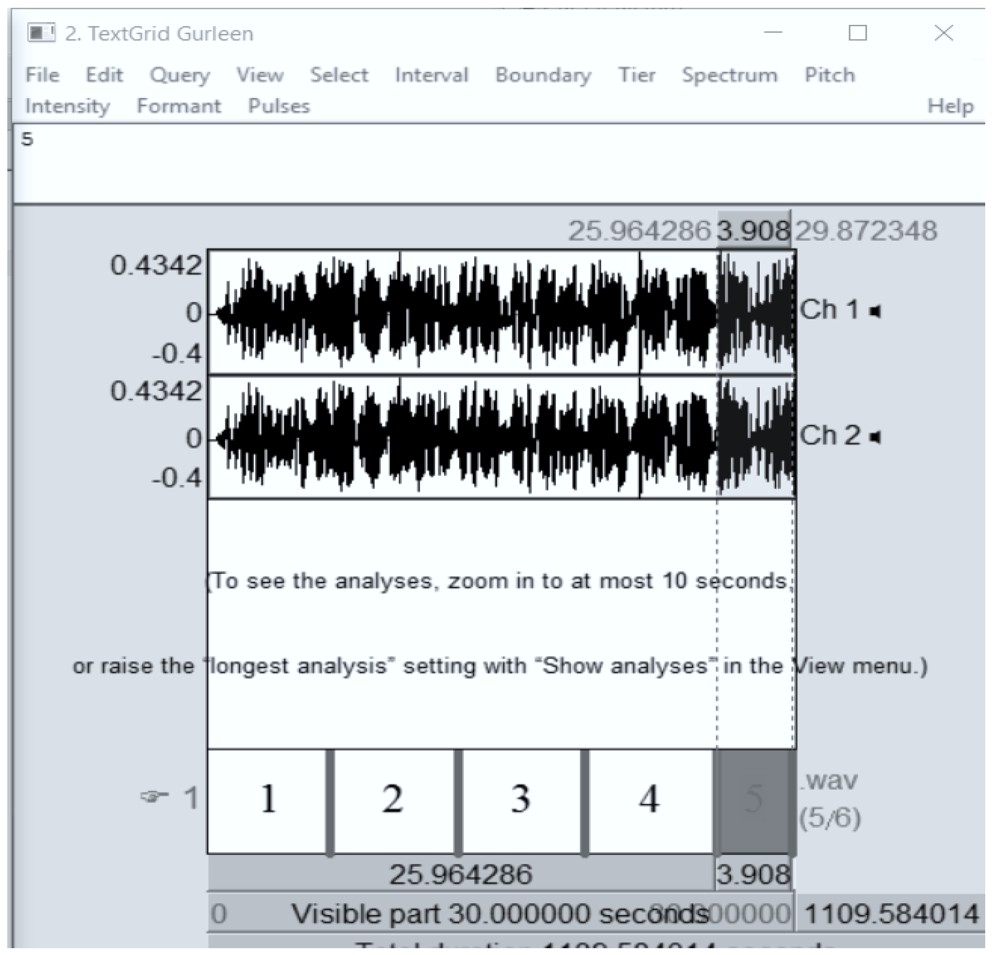 Developing a Speech Recognition System for Recognizing Tonal Speech Signals Using a ...