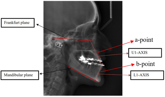 Comparative Assessment of Perception about Angle Inclination of ...