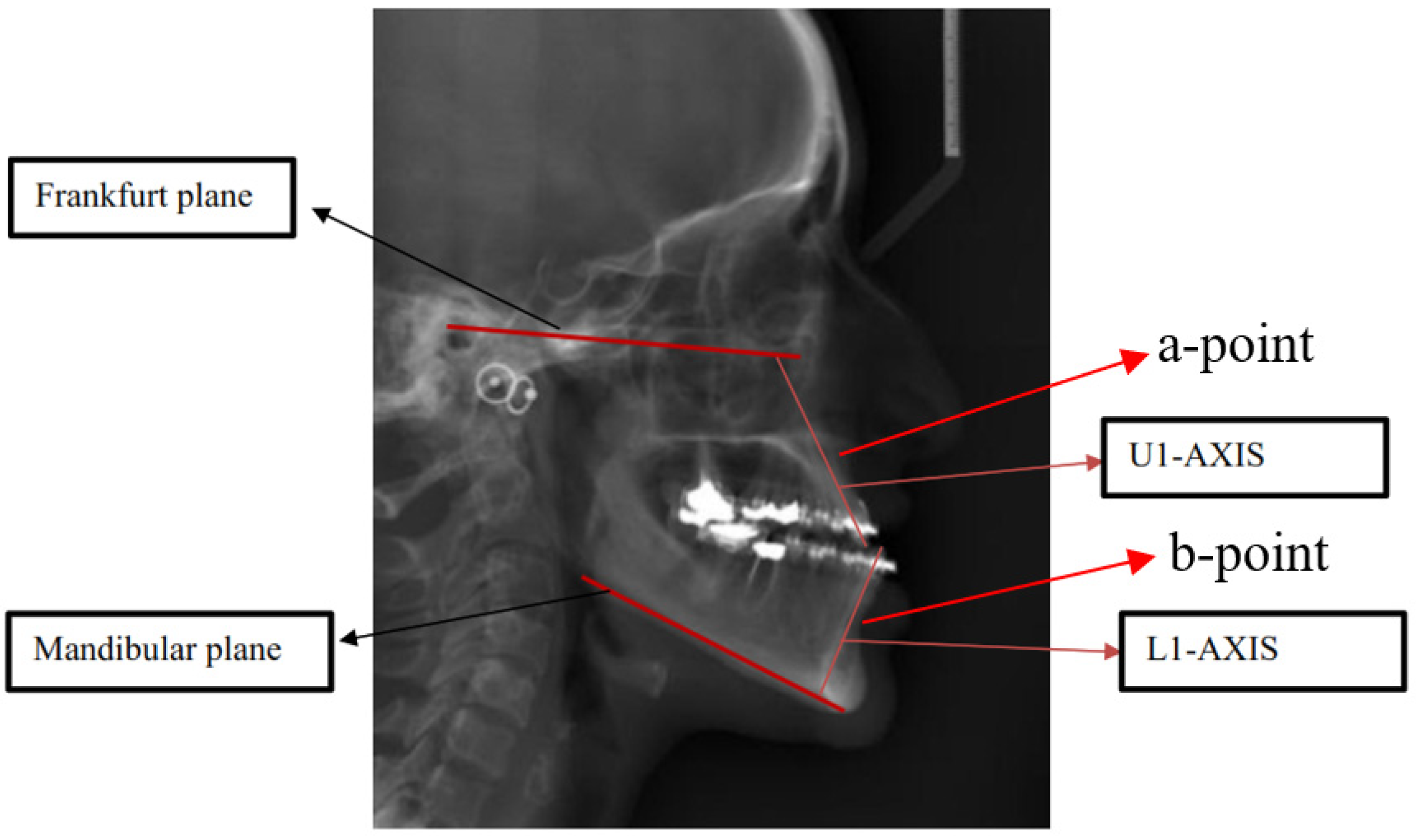 Comparative Assessment of Perception about Angle Inclination of ...