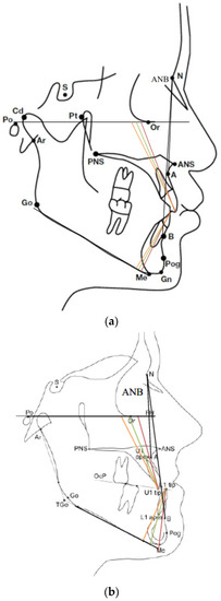 Comparative Assessment of Perception about Angle Inclination of ...