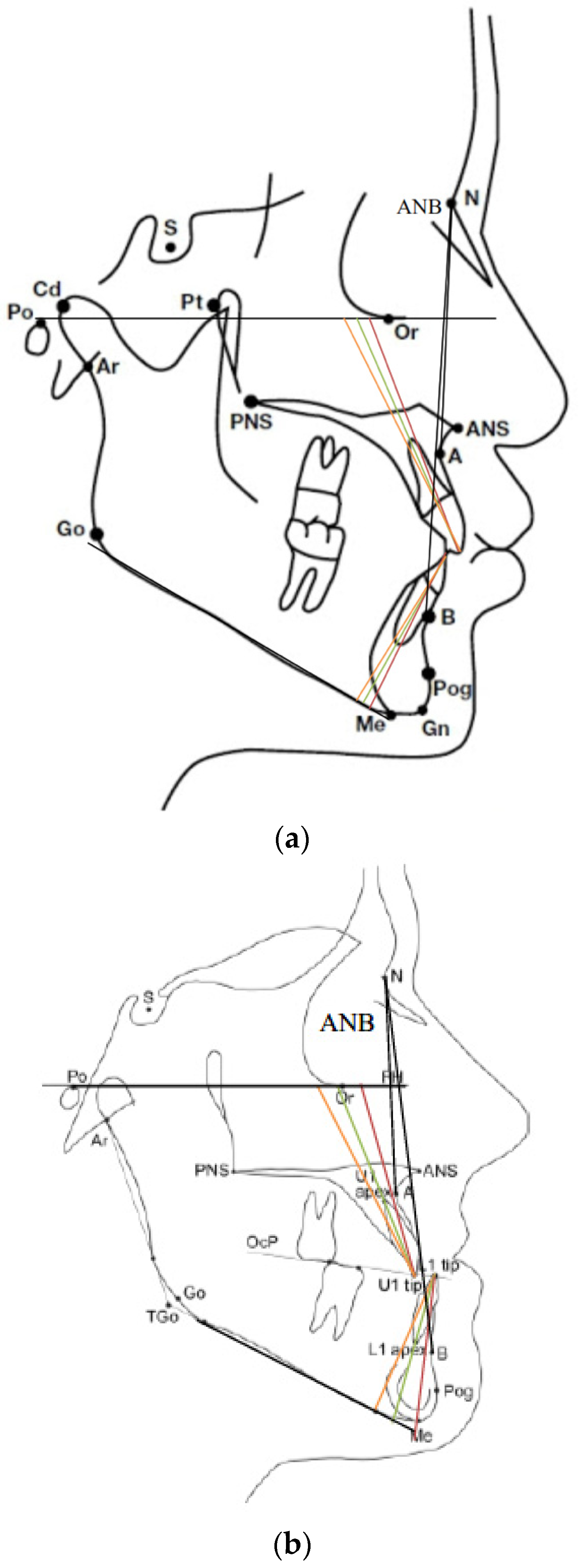 Comparative Assessment of Perception about Angle Inclination of ...