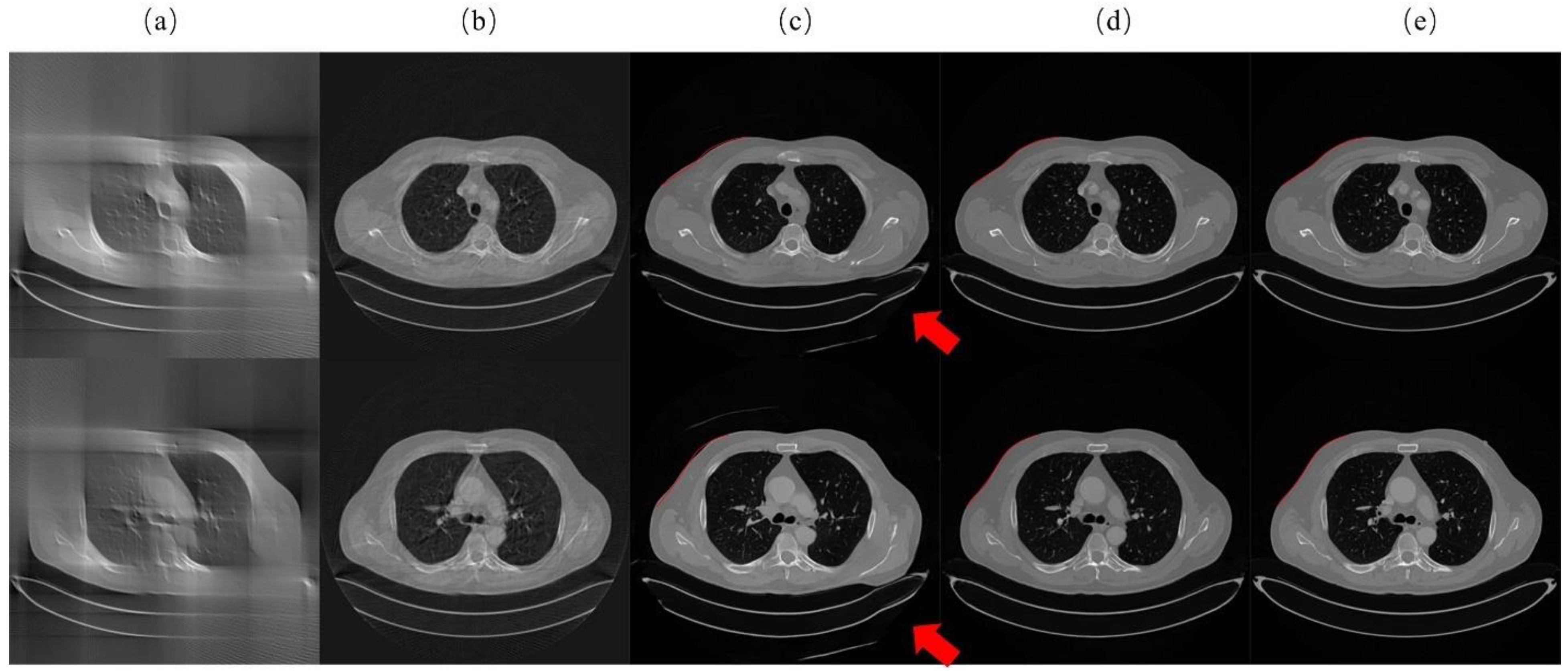 Limited-Angle CT Reconstruction with Generative Adversarial Network ...