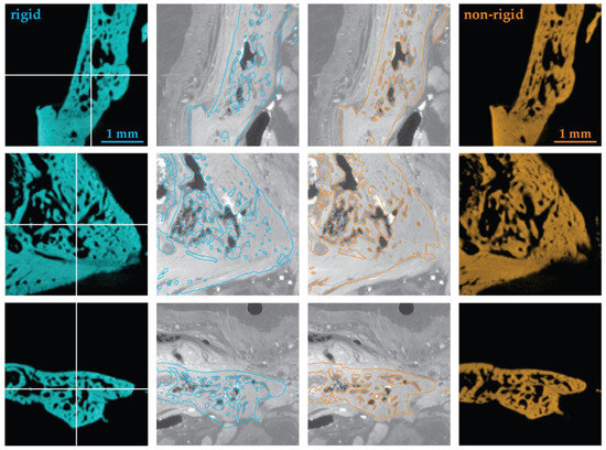 Medical Image Analysis