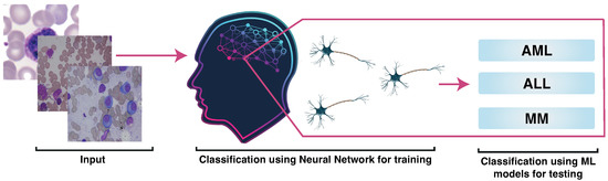 Detecting Malignant Leukemia Cells Using Microscopic Blood Smear Images ...