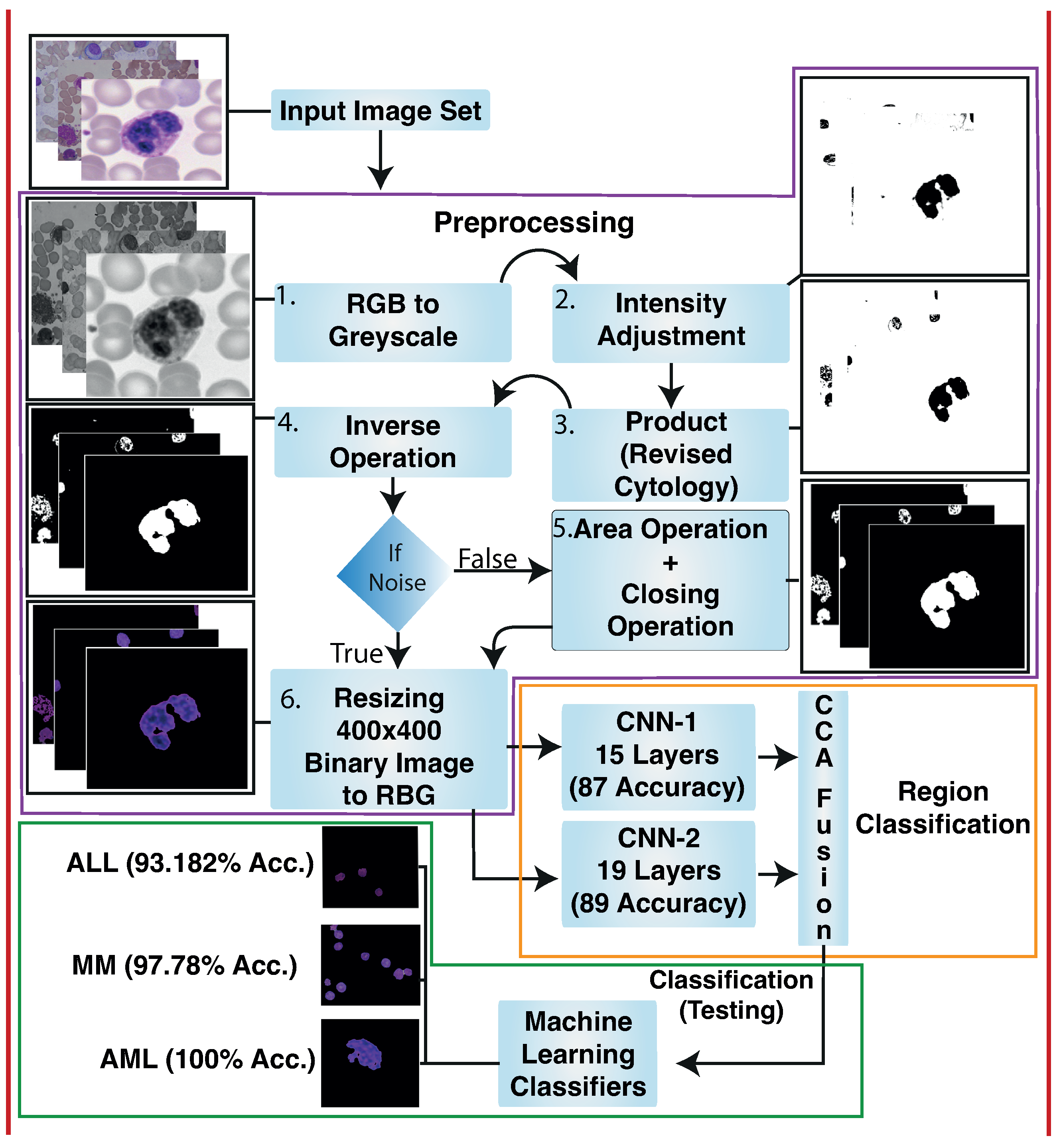 Detecting Malignant Leukemia Cells Using Microscopic Blood Smear Images ...