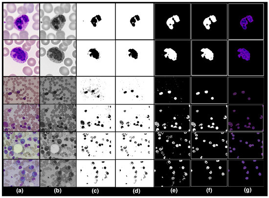Detecting Malignant Leukemia Cells Using Microscopic Blood Smear Images ...