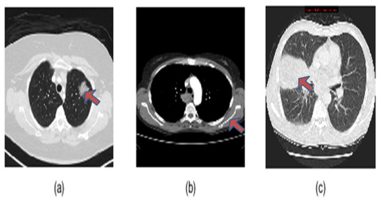 Applied Sciences | Free Full-Text | DETECT-LC: A 3D Deep Learning and ...