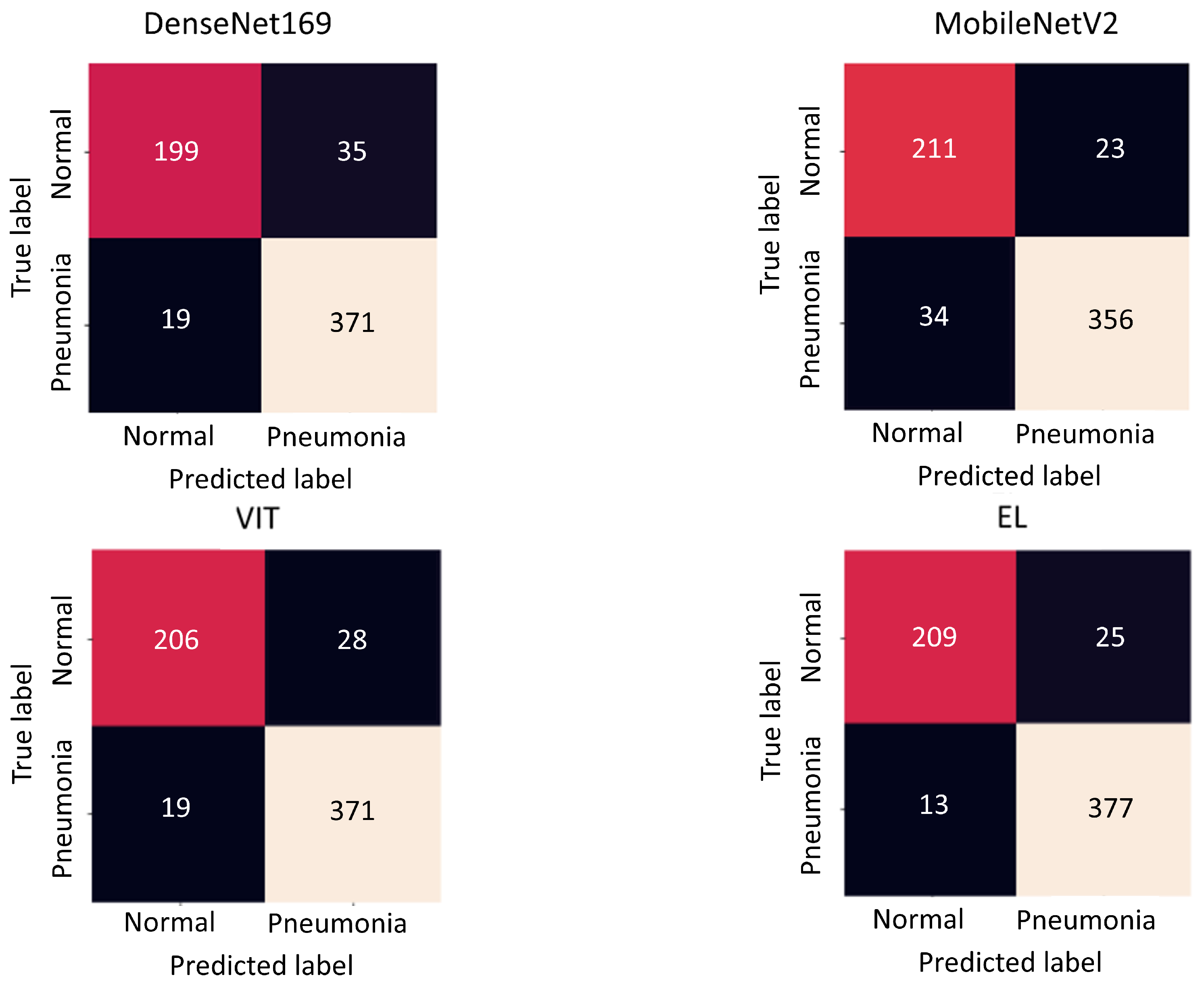 Pneumonia Detection on Chest X-ray Images Using Ensemble of Deep Convolutional Neural Networks