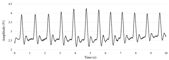 Applied Sciences | Free Full-Text | A Photoplethysmogram Dataset for ...