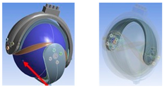 The Design of a Smart Lower-Limb Prosthesis Supporting People with ...