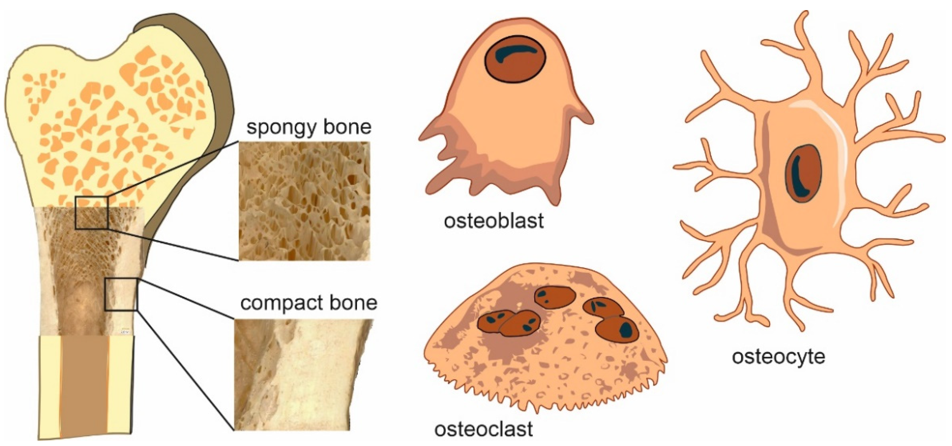 Applied Sciences | Free Full-Text | Nanomaterials in Bone Regeneration