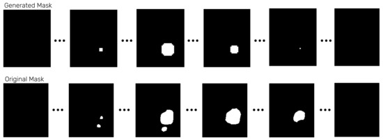 Transfer Learning from Healthy to Unhealthy Patients for the Automated ...
