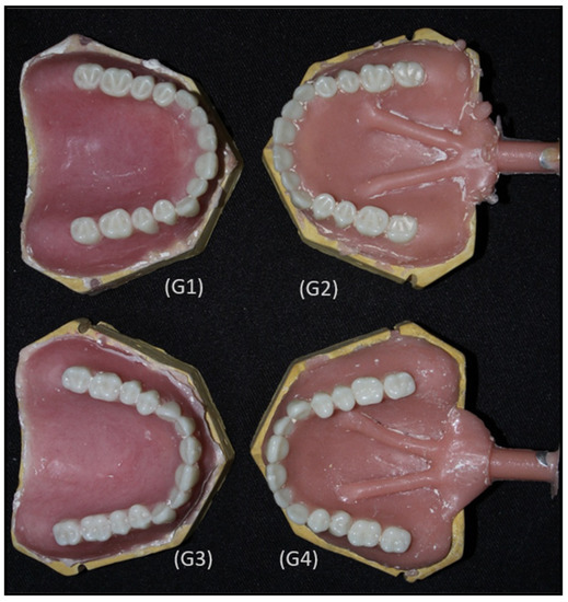Linear Dimensional Change in Acrylic Denture Teeth Positions Factored ...