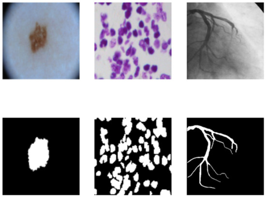 Residual-Attention UNet++: A Nested Residual-Attention U-Net for ...