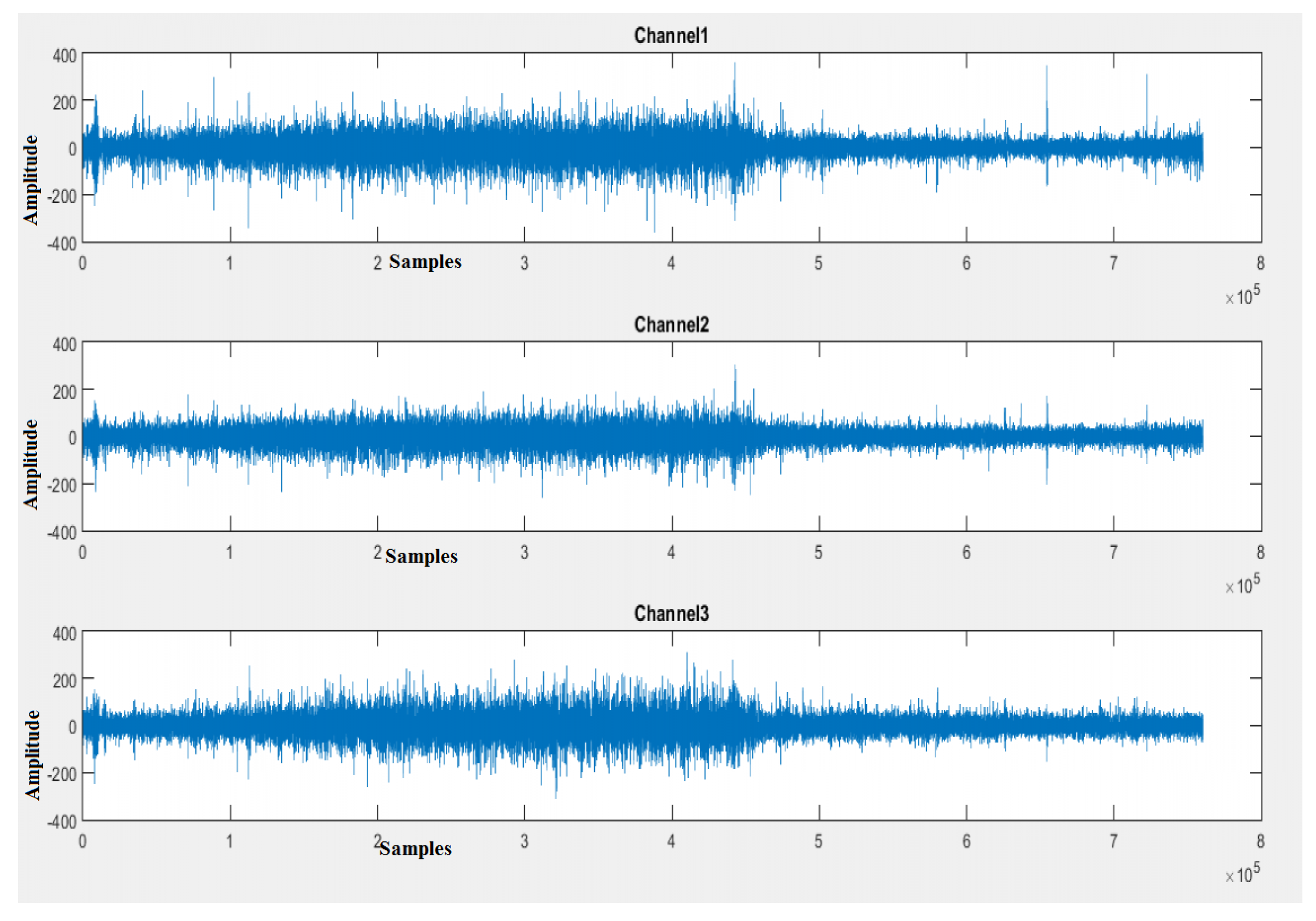 Applied Sciences Free Full Text Classification Of Eeg Signals For Prediction Of Epileptic