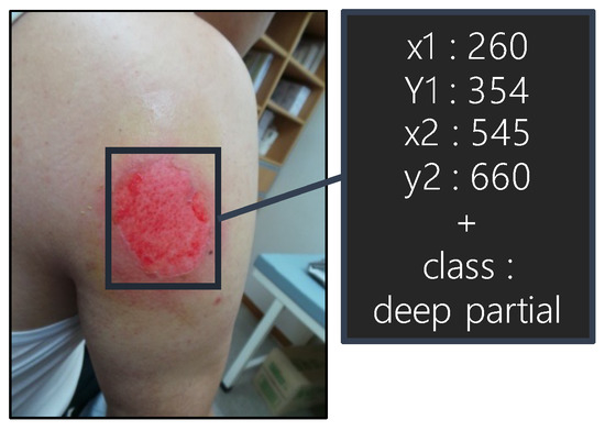 Sample-Efficient Deep Learning Techniques for Burn Severity Assessment ...