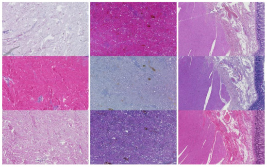 H&E Multi-Laboratory Staining Variance Exploration with Machine Learning