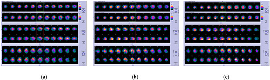 An Explainable Classification Method of SPECT Myocardial Perfusion ...