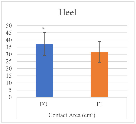 Immediate Effect of Customized Foot Orthosis on Plantar Pressure and ...