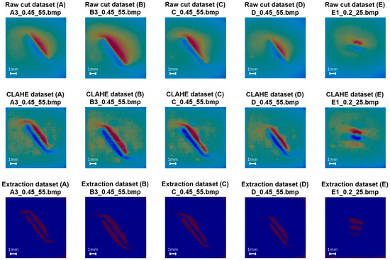 Defect Shape Classification Using Transfer Learning in Deep Convolutional Neural Network on ...