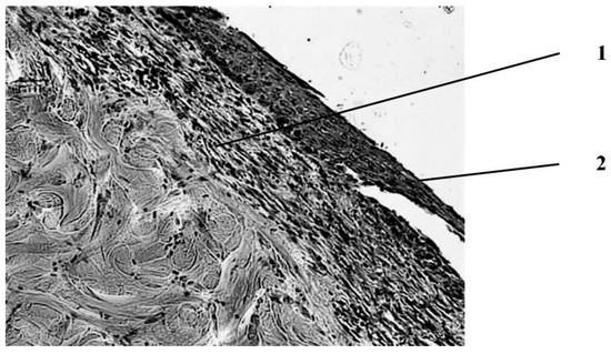 Estimation of Effectiveness of Local Reactive Oxygen Species for ...