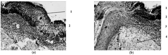Estimation of Effectiveness of Local Reactive Oxygen Species for ...