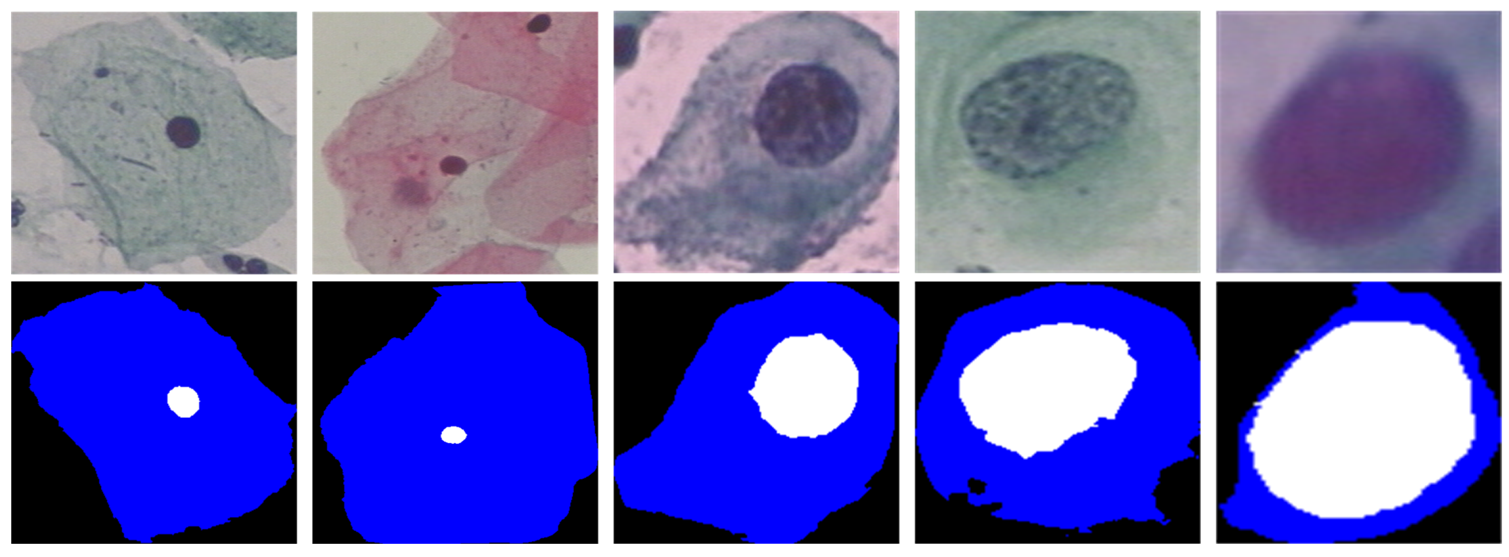 In Shape Of Normal Cervix Cell Under Microscope