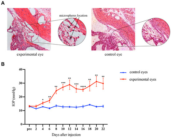 Applied Sciences | Free Full-Text | Effects of Ocular Hypertension on ...
