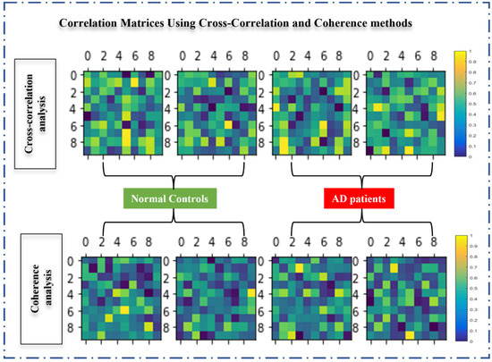 Comparison of Functional Connectivity Analysis Methods in Alzheimer’s ...