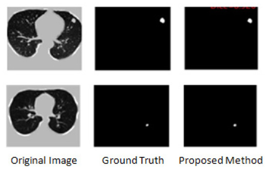 Effective Framework for Pulmonary Nodule Classification from CT Images Using the Modified ...