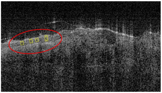 The Effect of Different Optical Clearing Agents on the Attenuation ...
