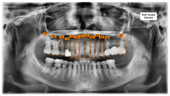 Deep Learning Model for Classifying Periodontitis Stages on Dental ...