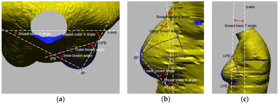 Breast Geometry Characterization of Young American Females Using 3D ...