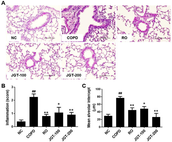 Anti-Inflammatory and Anti-Airway Remodeling Activities of Jakyakgamcho ...