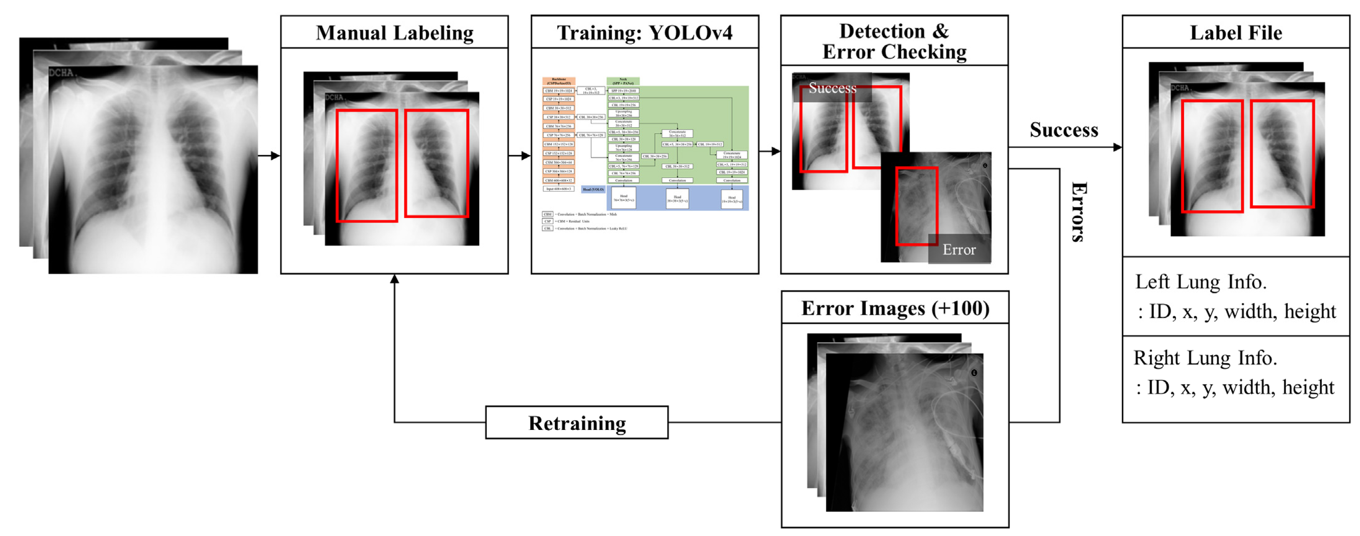 A Two-Step Learning Model for the Diagnosis of Coronavirus Disease-19 ...