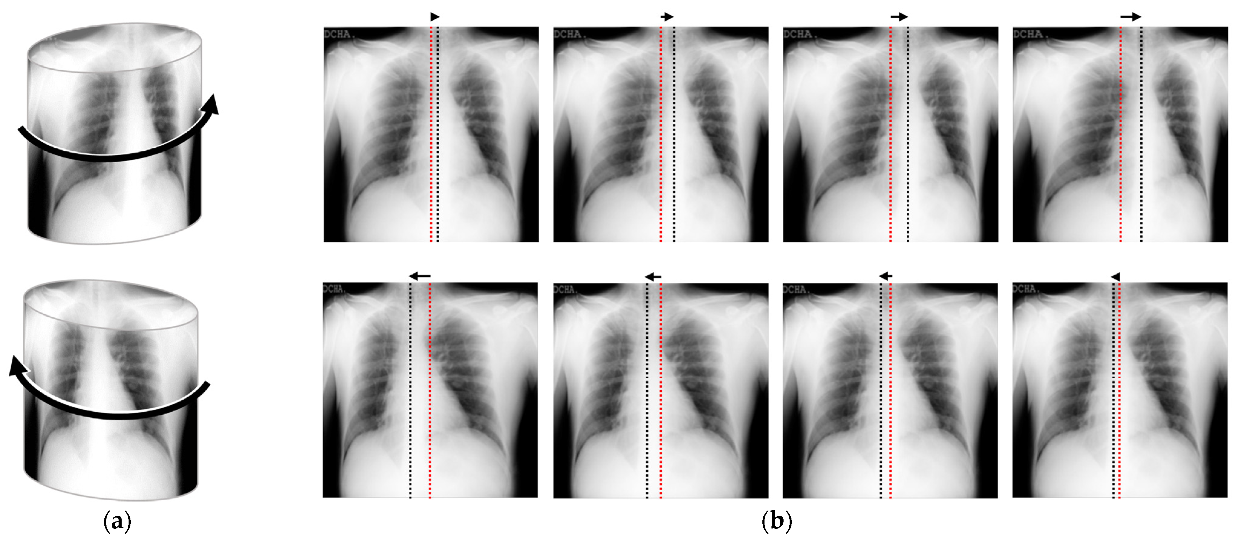 A Two-Step Learning Model for the Diagnosis of Coronavirus Disease-19 ...