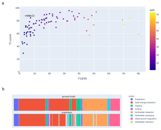 Surgical Phase Recognition: From Public Datasets to Real-World Data