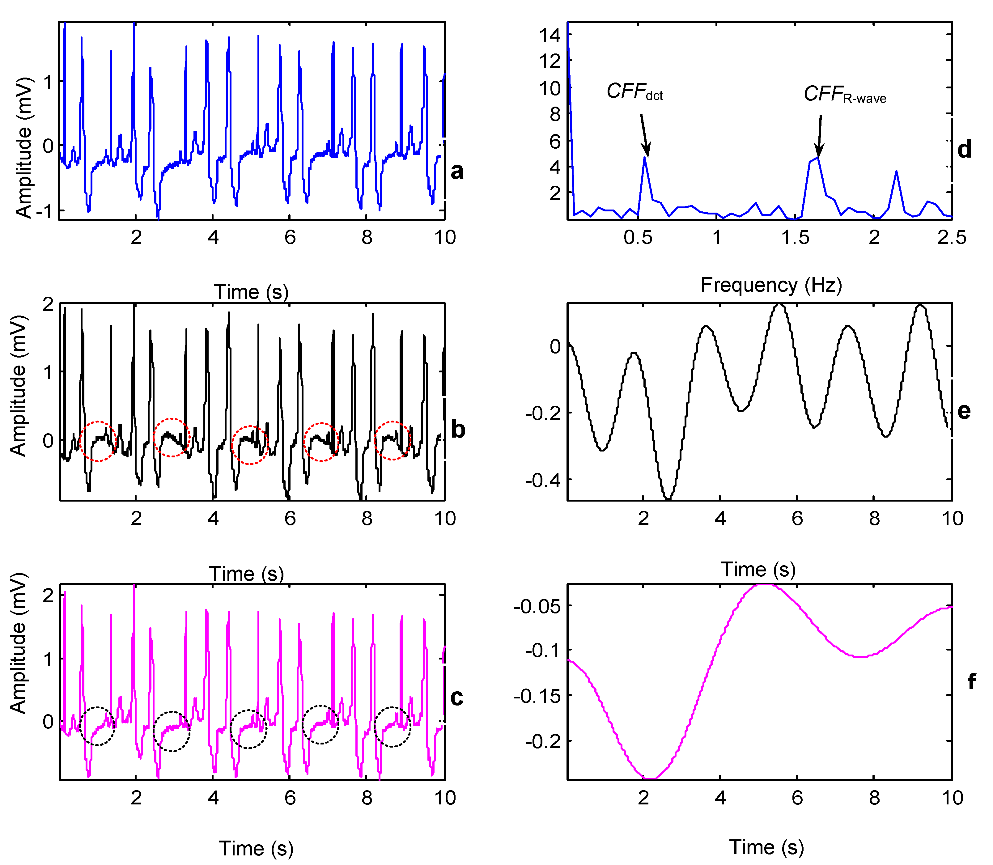 A Dual-Adaptive Approach Based on Discrete Cosine Transform for Removal of ECG Baseline Wander